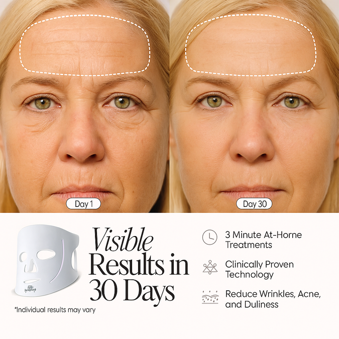 Lumi LED Face Mask – 7 Colors to Reduce Wrinkles & Acne Fast – GLOWLINE